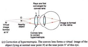 Defects of Vision and their Correction - Class 10, The Human Eyes and ...