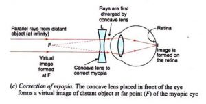 Defects of Vision and their Correction - Class 10, The Human Eyes and ...