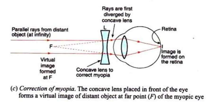 Defects of Vision and their Correction - Class 10, The Human Eyes and ...